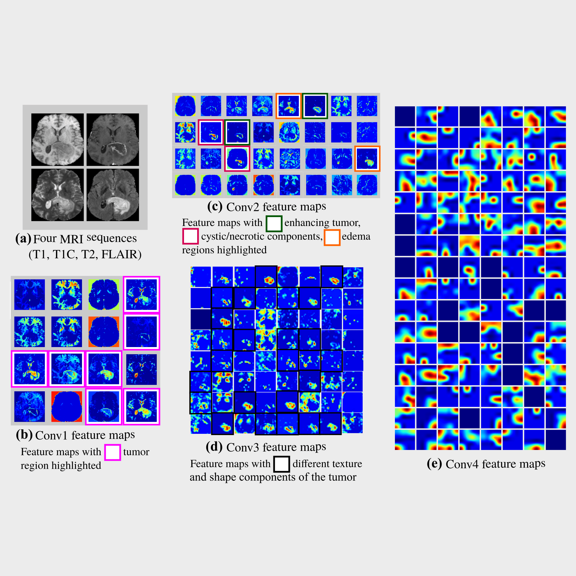 Brain Tumor Detection and Classification from Multi-Channel MRIs using ...