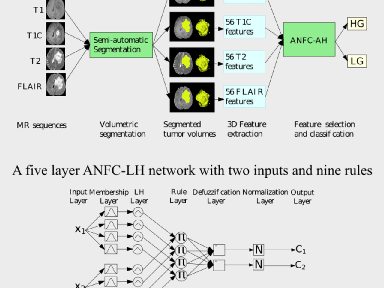 Synergetic Neuro Fuzzy Feature Selection And Classification Of Brain