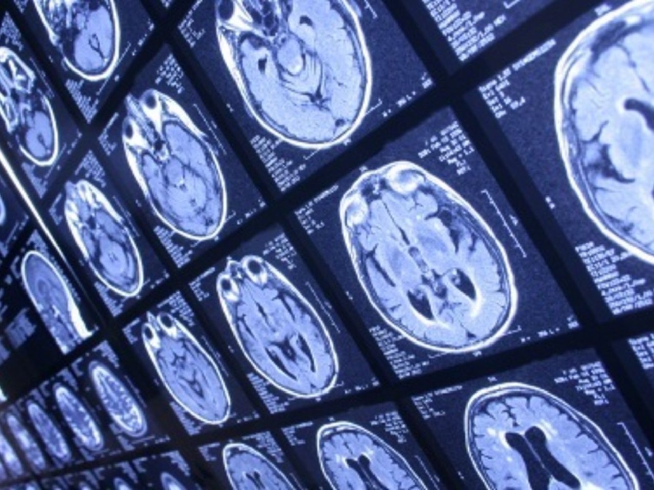 Medical Image Segmentation Using Deep Learning Intel Devmesh