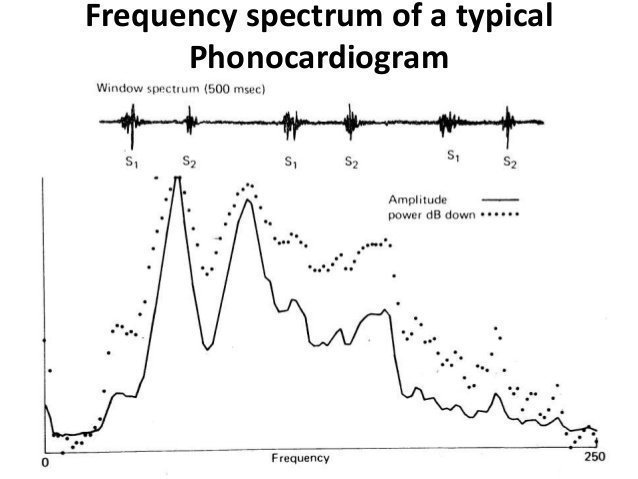 Phonocardiogram Classification | Intel DevMesh | Aritra Roy Gosthipaty ...