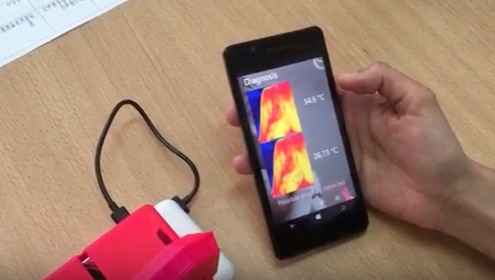 Infrared thermal camera to detect breast cancer | Intel DevMesh | zayen ...