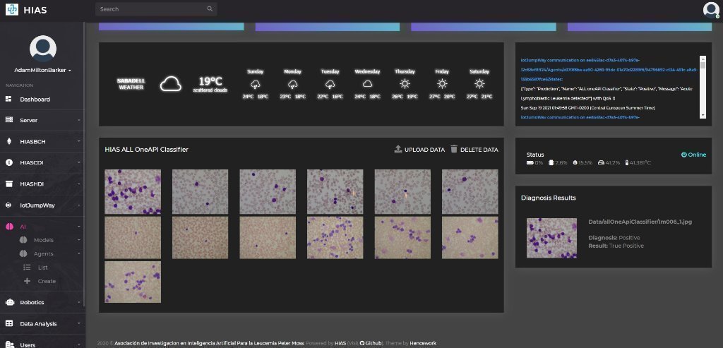 Detecting Acute Lymphoblastic Leukemia Lymphoblasts with Tensorflow ...