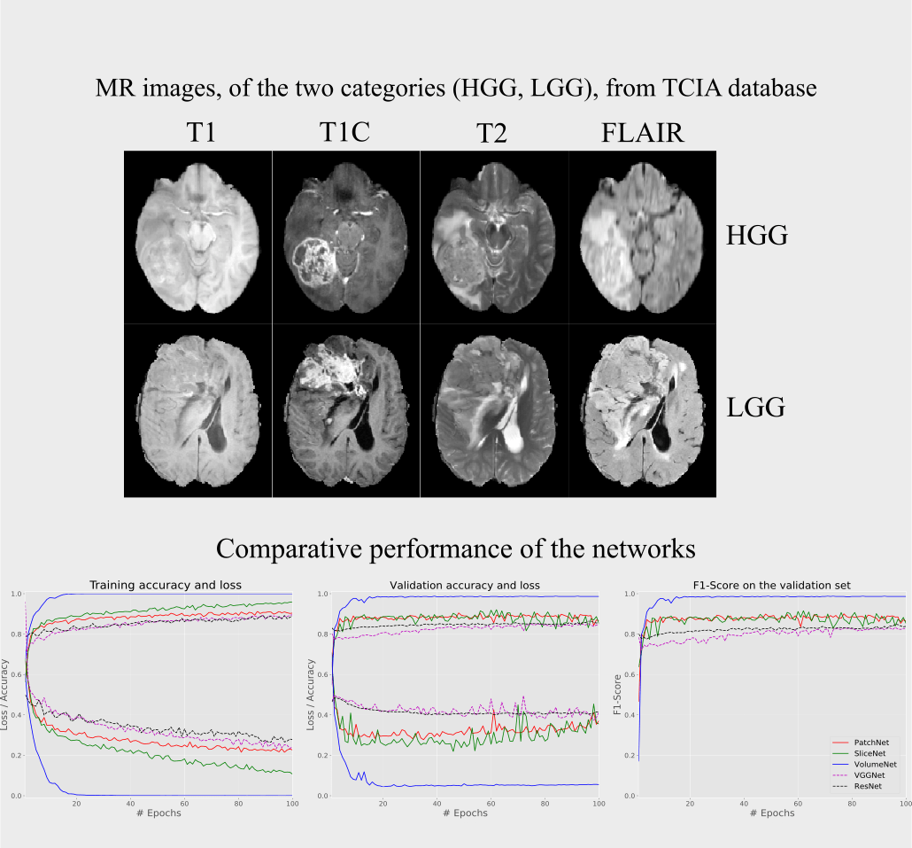 Brain Tumor Detection And Classification From Multi C